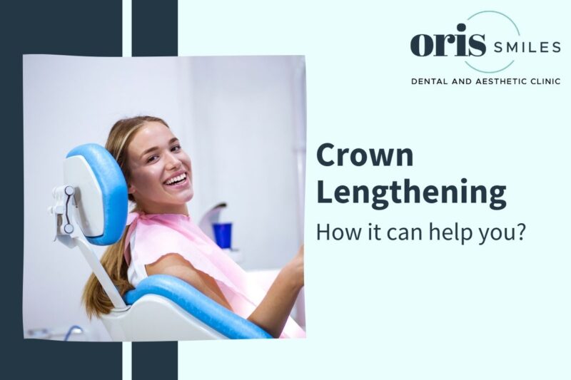 How can Crown Lengthening help you? - Oris Smiles