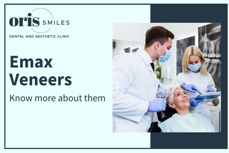 What are e max veneers - Oris Smiles
